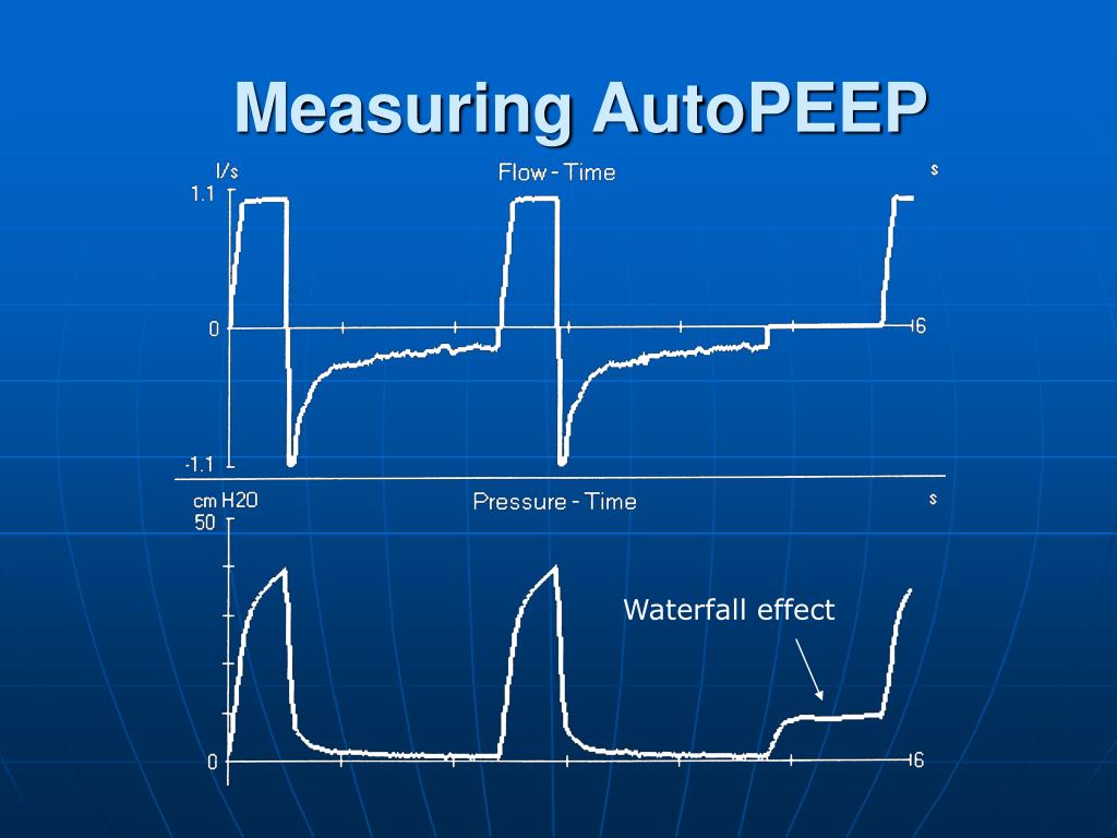 PPT - Ventilator waveform analysis: often ignored bedside assessment ... PPT - Ventilator waveform analysis: often ignored bedside assessment ...