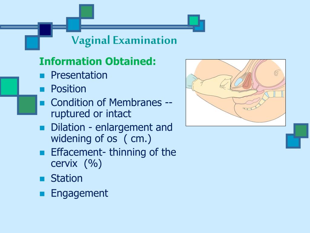 Ppt Nursing Care During Labor And Delivery Powerpoint Presentation