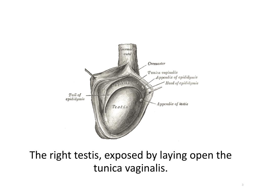 Ppt Torsion Of The Testis Or Of The Spermatic Cord Powerpoint