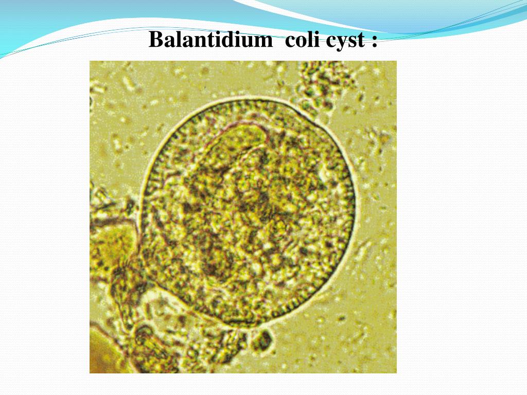 Ppt Urine And Stool Examination Powerpoint Presentation Free Download Id1001082