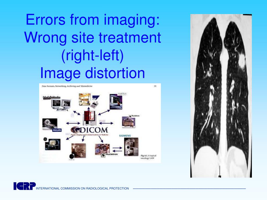PPT - Preventing accidental exposures from new external beam radiation ...