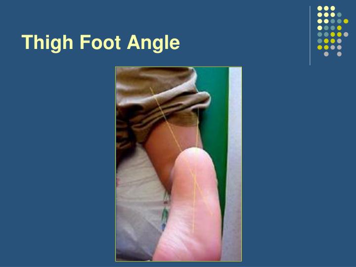 PPT - Rotational and Angular Deformities in Children PowerPoint ...