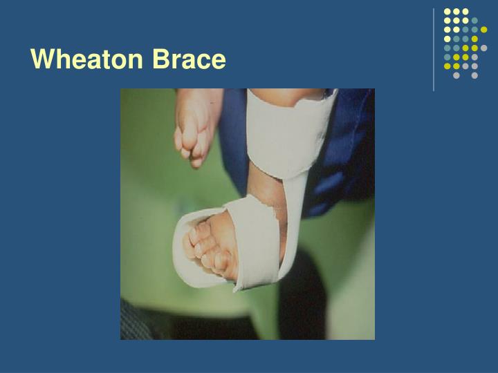 PPT - Rotational and Angular Deformities in Children PowerPoint ...