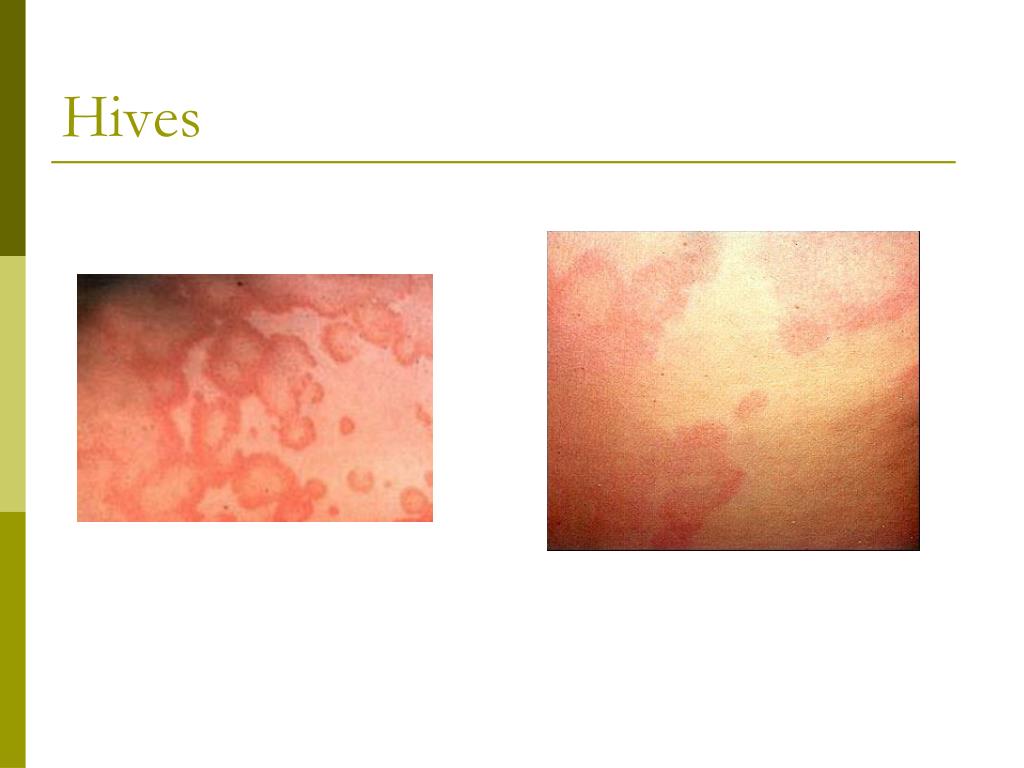 Ppt Dermatology Powerpoint Presentation Free Download Id 1013075