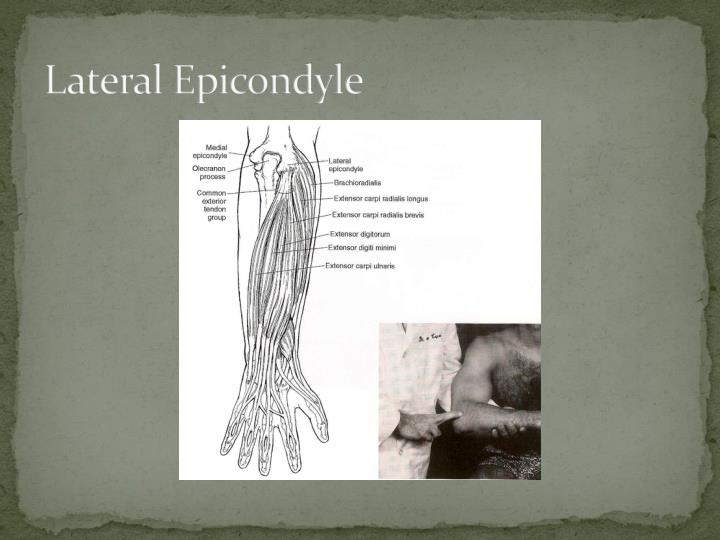 PPT - Introduction to Upper Extremity Orthopedic Tests PowerPoint ...