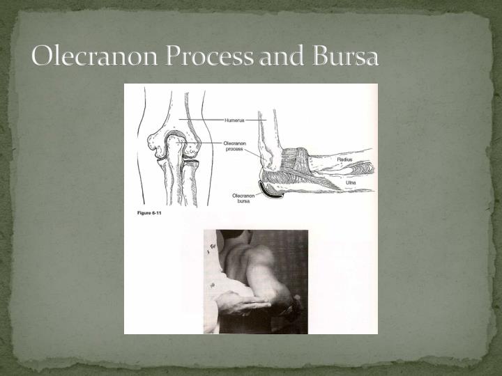 PPT - Introduction to Upper Extremity Orthopedic Tests PowerPoint ...