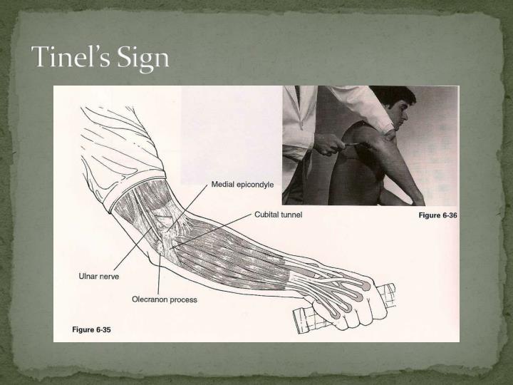 PPT - Introduction to Upper Extremity Orthopedic Tests PowerPoint ...