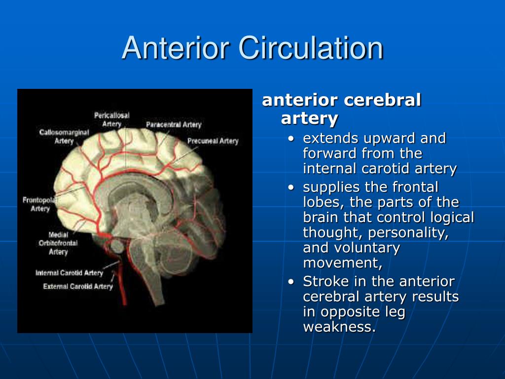 PPT - CVD: STROKE Septemius A. Pansacola RN,MD PowerPoint Presentation ...
