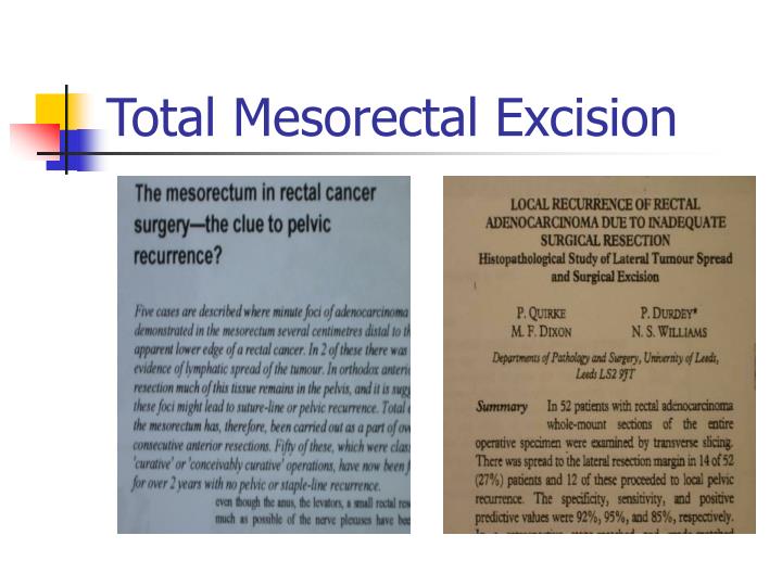 PPT - Total Mesorectal Excision PowerPoint Presentation - ID:1015380