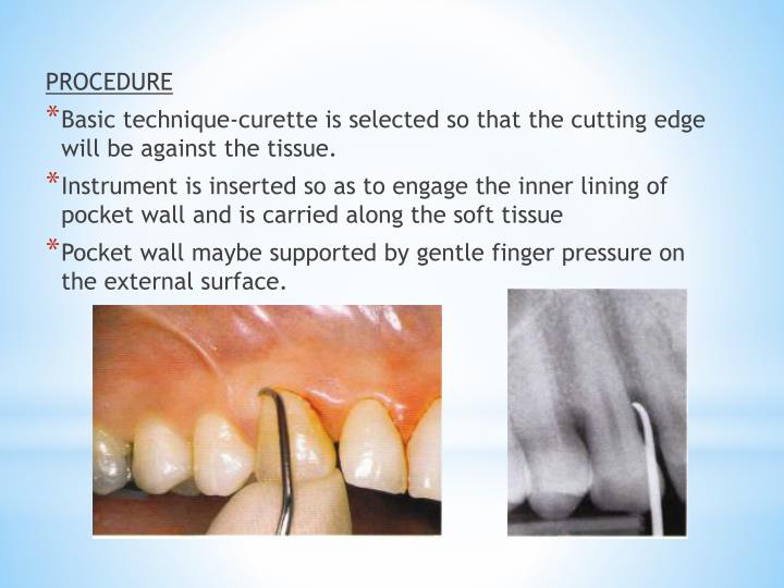 PPT - Surgical Periodontal Therapy PowerPoint Presentation - ID:1016139