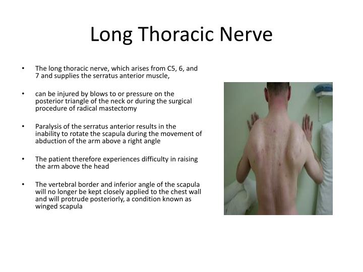 PPT - Nerve injuries PowerPoint Presentation - ID:1018285