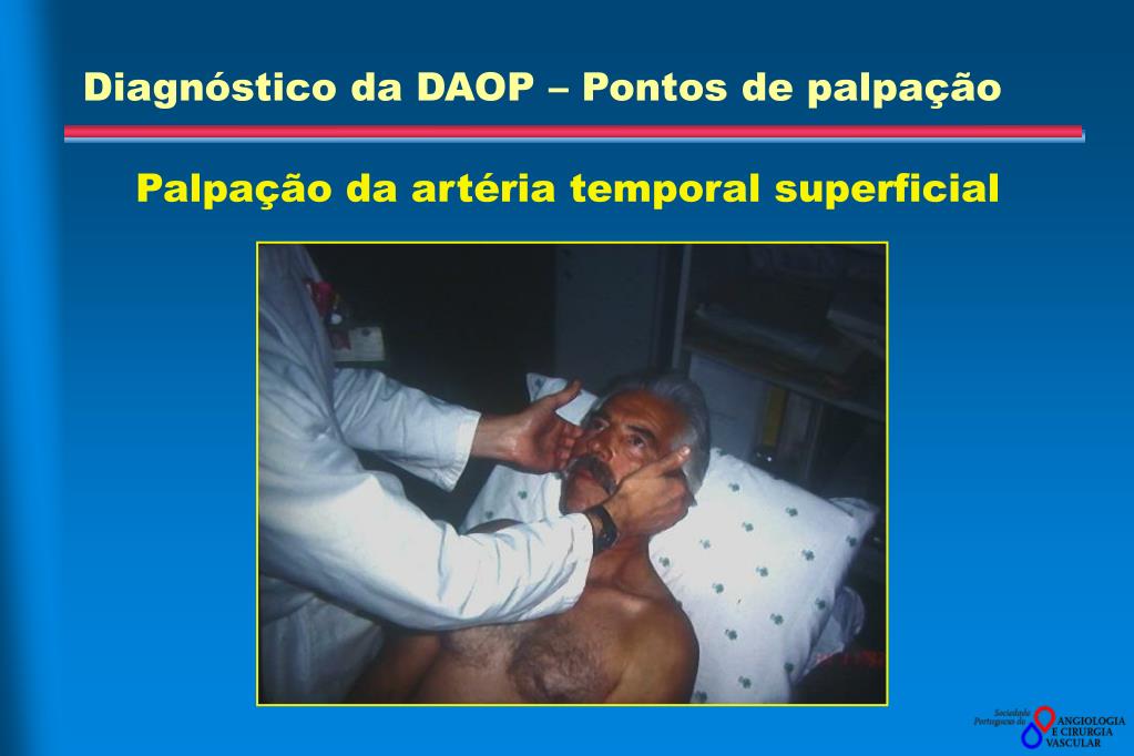 PPT - Doença arterial obstrutiva periférica (DAOP) PowerPoint ...