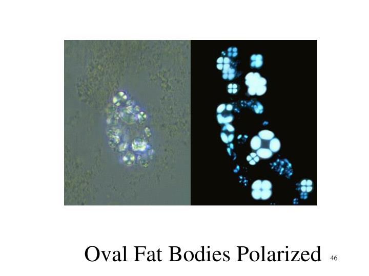 PPT - URINALYSIS PowerPoint Presentation - ID:1020869