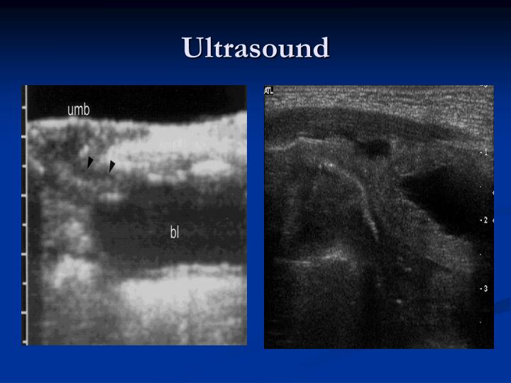 PPT - Pediatric Umbilical Abnormalities PowerPoint Presentation - ID ...