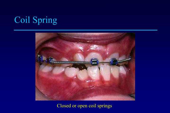 PPT - DENT 656 – Orthodontics PowerPoint Presentation - ID:1022719