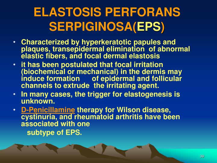 PPT - Elastic Tissue disorders PowerPoint Presentation - ID:1023203