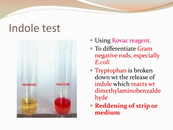 Indole Test