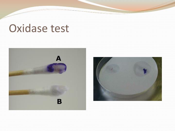 Oxidase Test