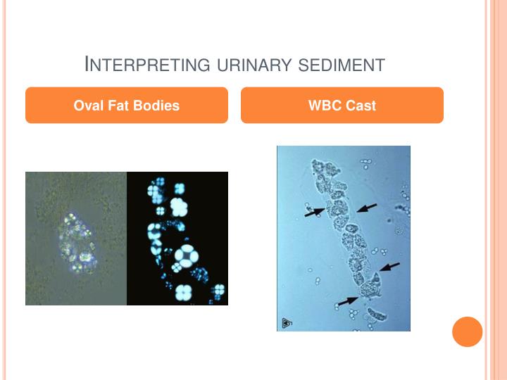 PPT - Acute Kidney Injury PowerPoint Presentation - ID:1031273