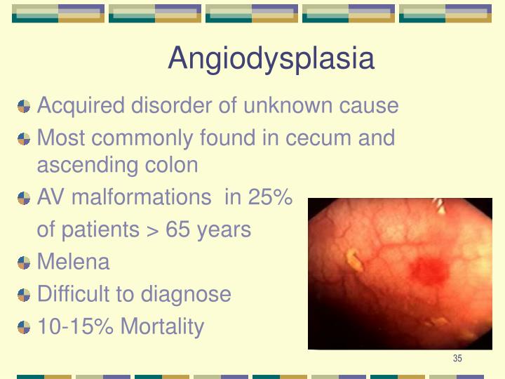 PPT - Abdominal Emergencies PowerPoint Presentation - ID:1032494