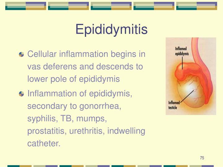 PPT - Abdominal Emergencies PowerPoint Presentation - ID:1032494