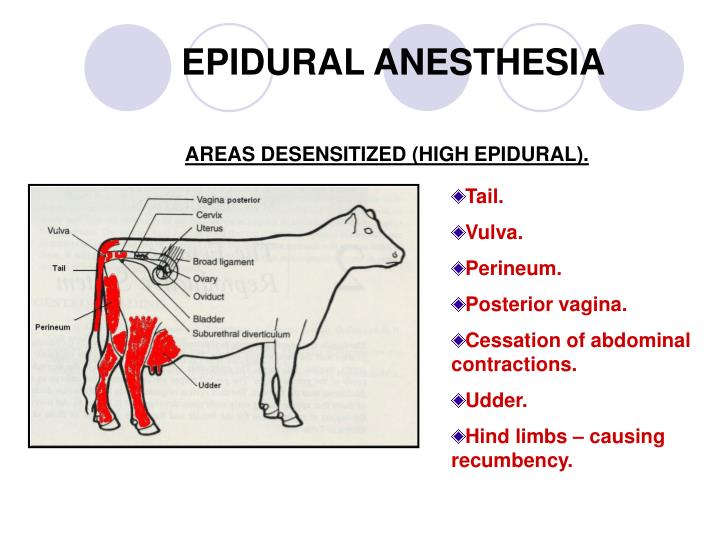 PPT - EPIDURAL ANESTHESIA PowerPoint Presentation - ID:1033201