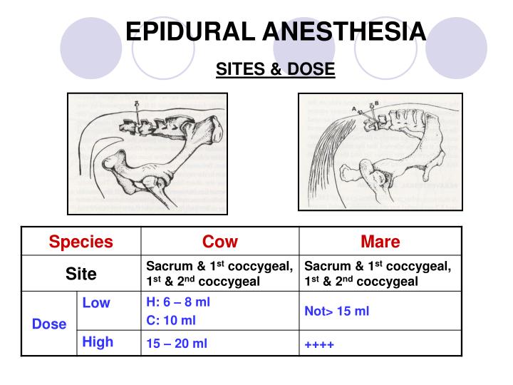 PPT - EPIDURAL ANESTHESIA PowerPoint Presentation - ID:1033201