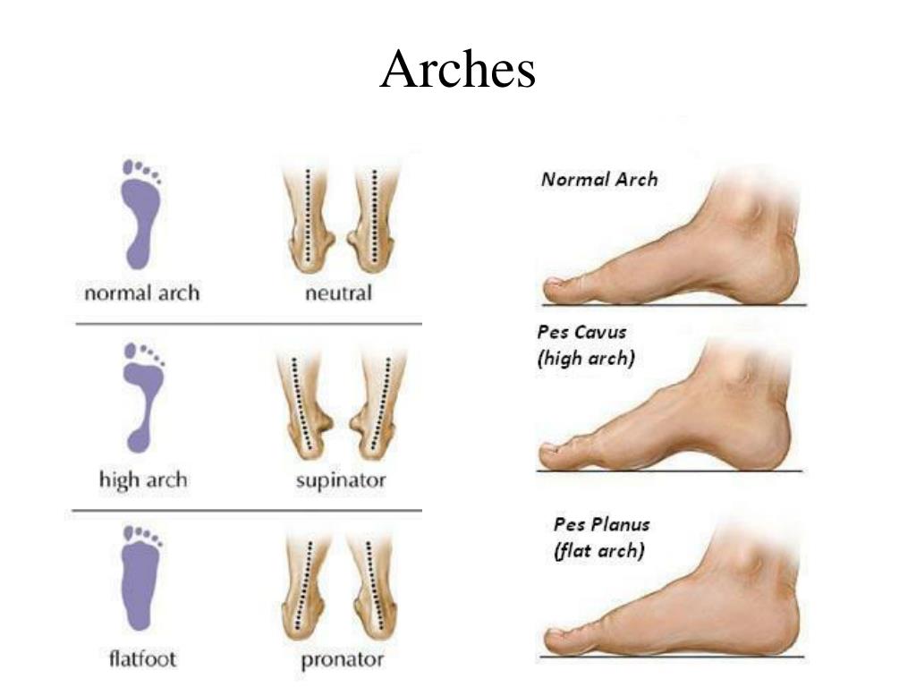 PPT The Foot PowerPoint Presentation Free Download ID 1033407 PPT The Foot PowerPoint Presentation Free Download ID 1033407