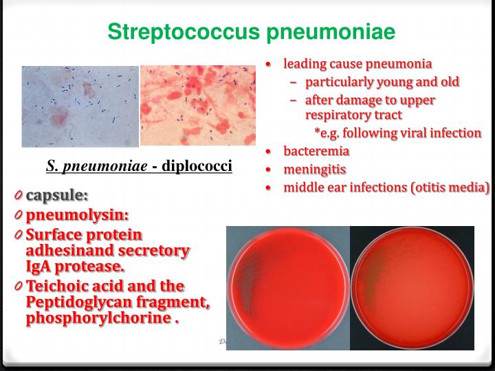 PPT - Streptococcus pneumina PowerPoint Presentation - ID:103888