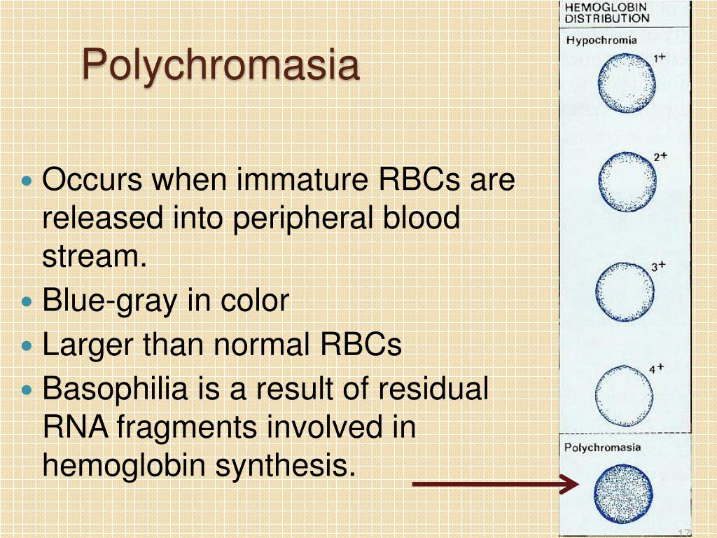PPT - MLAB 1415: Hematology Keri Brophy -Martinez PowerPoint ...