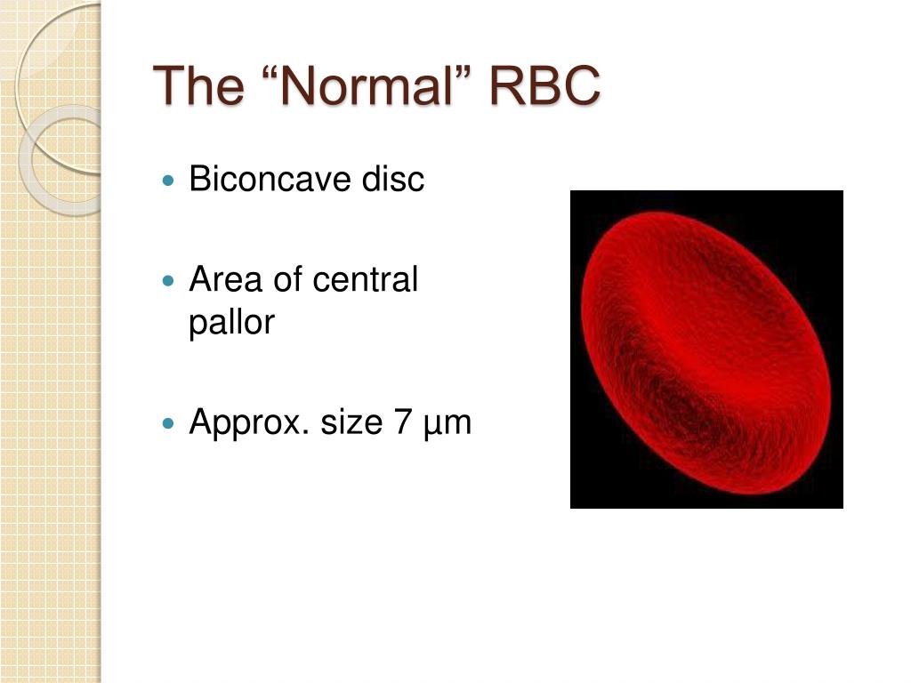 PPT - MLAB 1415: Hematology Keri Brophy -Martinez PowerPoint ...