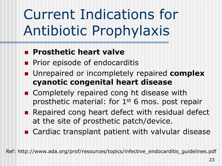 PPT - Infective Endocarditis PowerPoint Presentation - ID:1048982