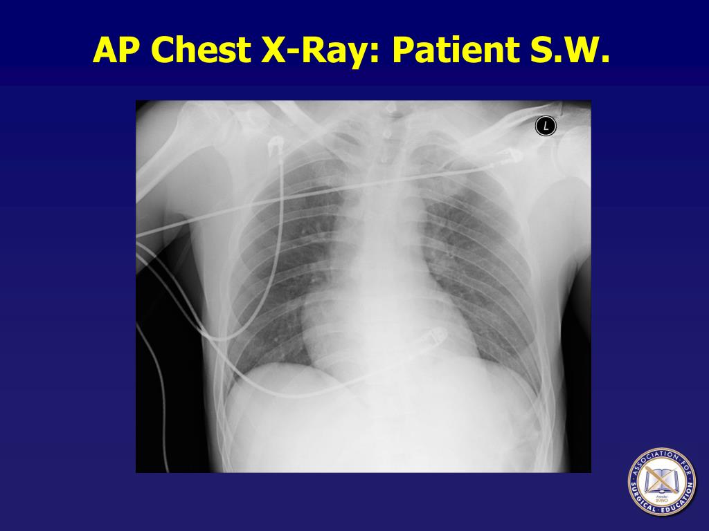 PPT - TRAUMA Stab Wound to the Chest: Cardiac Tamponade PowerPoint ...