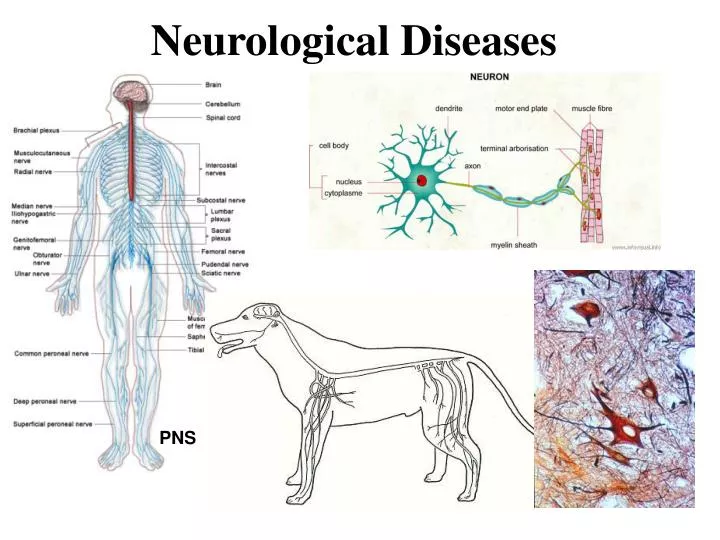 PPT - Neurological Diseases PowerPoint Presentation, free download - ID ...