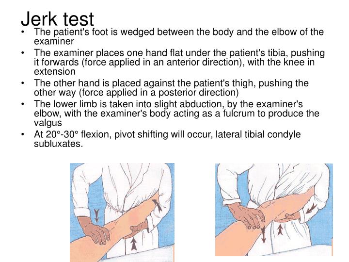 PPT - Injuries of the knee PowerPoint Presentation - ID:1058450