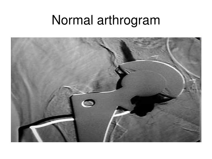 PPT - Injuries of the knee PowerPoint Presentation - ID:1058450