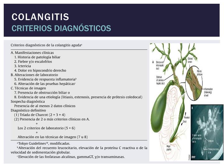 PPT - COLEDOCOLITIASIS Y COLANGITIS PowerPoint Presentation - ID:1063849