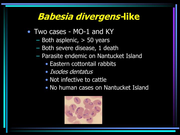 PPT - Babesiosis PowerPoint Presentation - ID:1064002