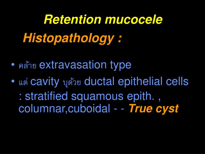 PPT - MUCOCELE & RANULA PowerPoint Presentation - ID:1067382