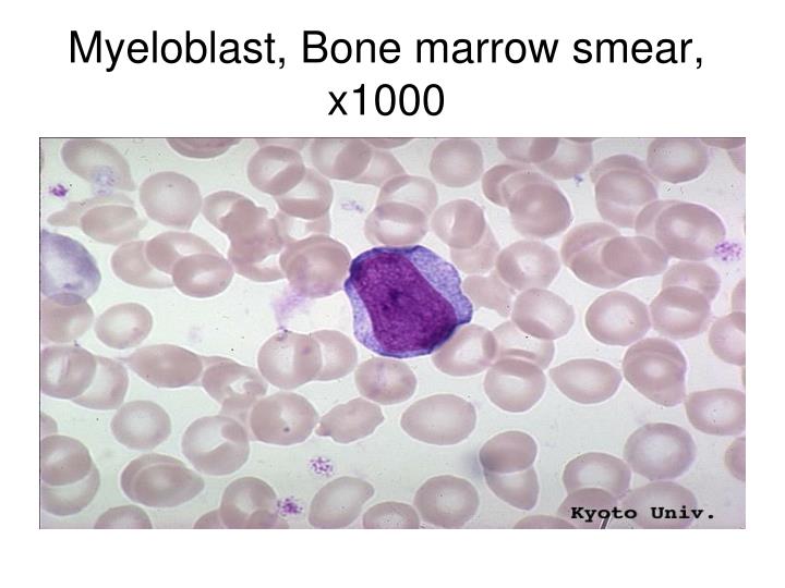 PPT - Proerythroblast, Bone marrow smear, x1000 PowerPoint Presentation ...
