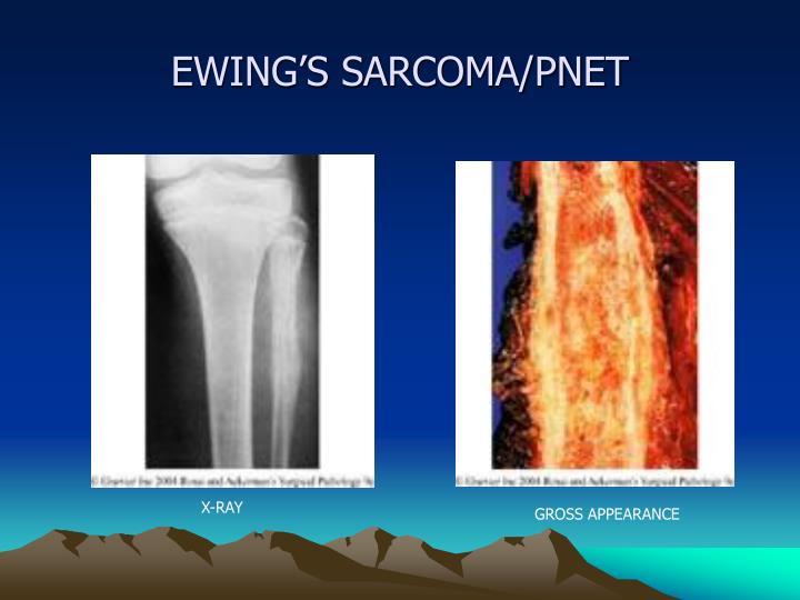 PPT - BONES AND MUSCLES PowerPoint Presentation - ID:1074073