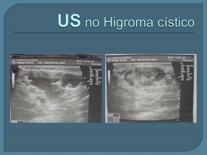 PPT - ANOMALIA VASCULAR: o que devemos saber para uma conduta ...