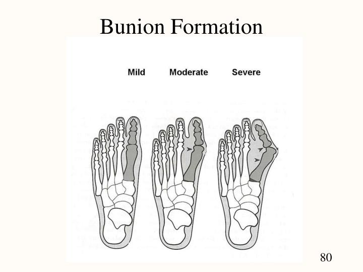 PPT - Chapter 8 The Skeletal System PowerPoint Presentation - ID:1074225