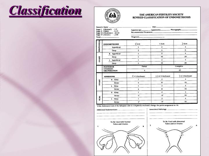 PPT - Les Masses Pelviennes PowerPoint Presentation - ID:1075441