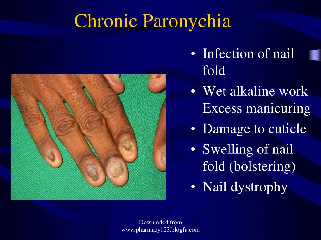 PPT - Management of Common Fungal & Bacterial Skin Infections ...