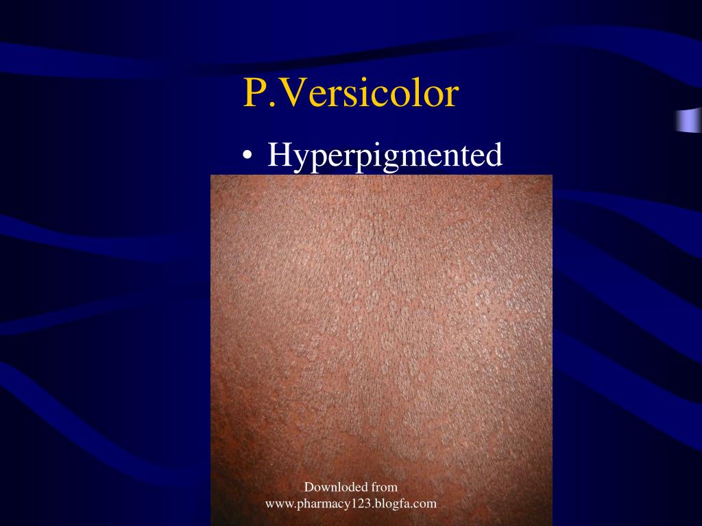 PPT - Management of Common Fungal & Bacterial Skin Infections ...