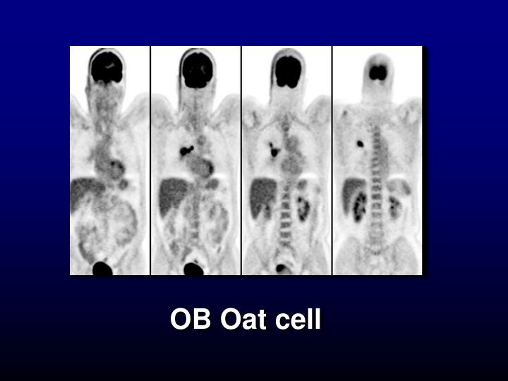 PPT - Métodos diagnósticos por imagens Medicina Nuclear PowerPoint ...