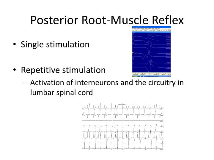 PPT - Functional Neuroanatomy of Spinal Cord PowerPoint Presentation ...