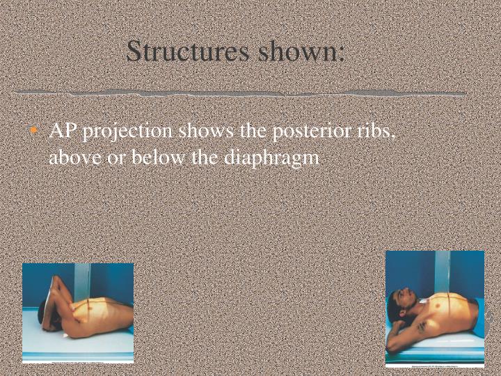 PPT - Bony Thorax PowerPoint Presentation - ID:1084911