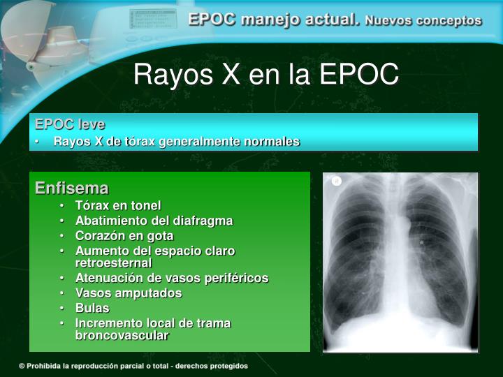 PPT - E.P.O.C PowerPoint Presentation - ID:1086953